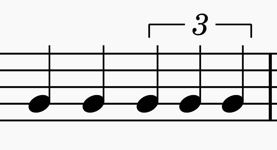 Music Theory: Note Values | Ultimate Guitar