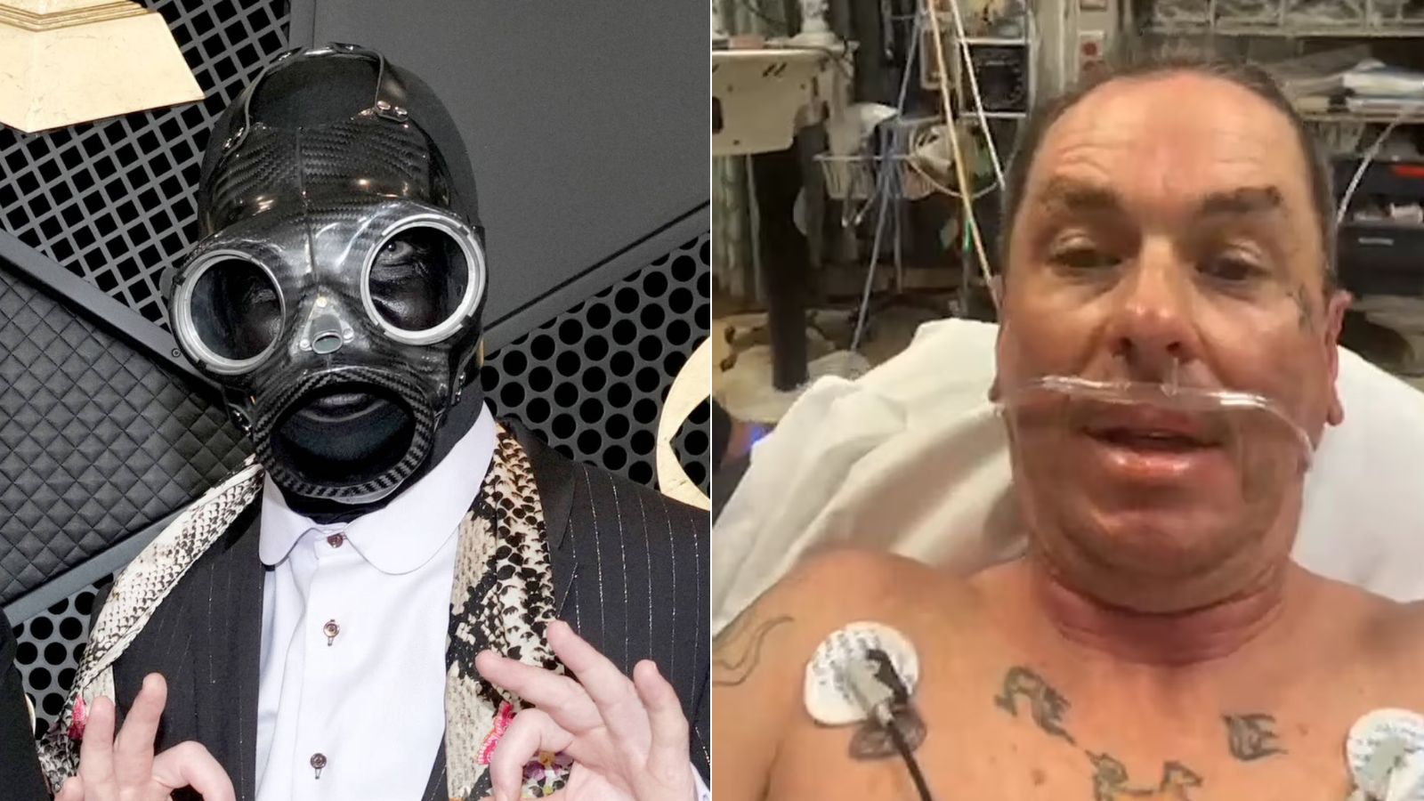 Slipknot's Sid Wilson Hospitalised With Burns After 'Bonfire Accident ...