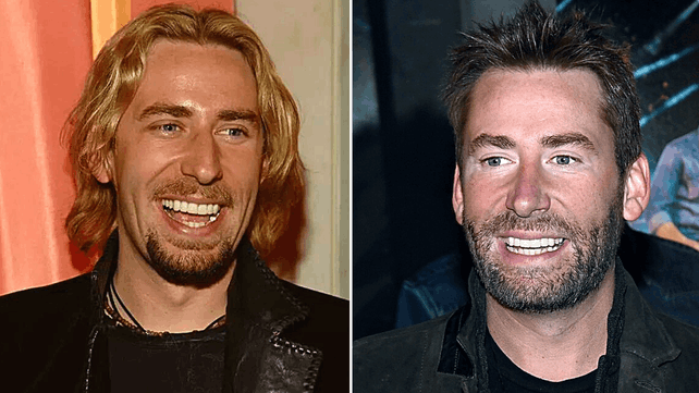 Chad Kroeger Recalls 'Burning the Candle at Both Ends' During ...