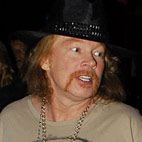 Axl 'Damaged' By Slash And Duff Comments | Ultimate Guitar